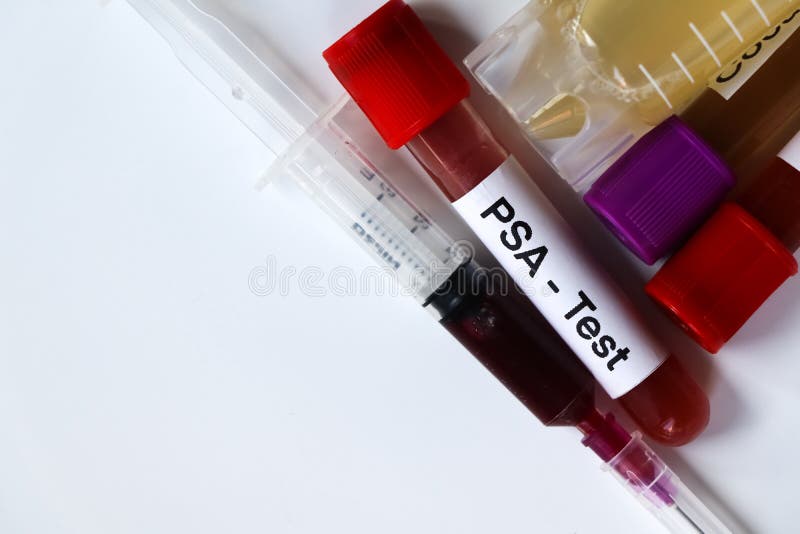 PSA Test To Look for Abnormalities from Blood Stock Photo - Image of ...
