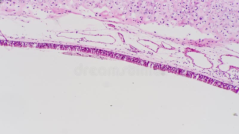 Pseudo Stratified Ciliated Columnar Epithelium of Human Being Under ...