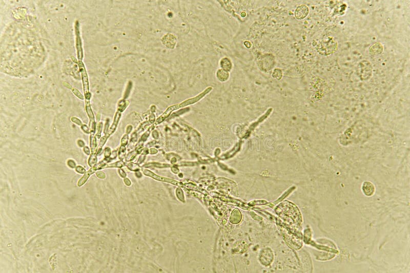 Pseudohyphae En Ontluikende Gistcellen in Urine Stock Foto - Image of ...