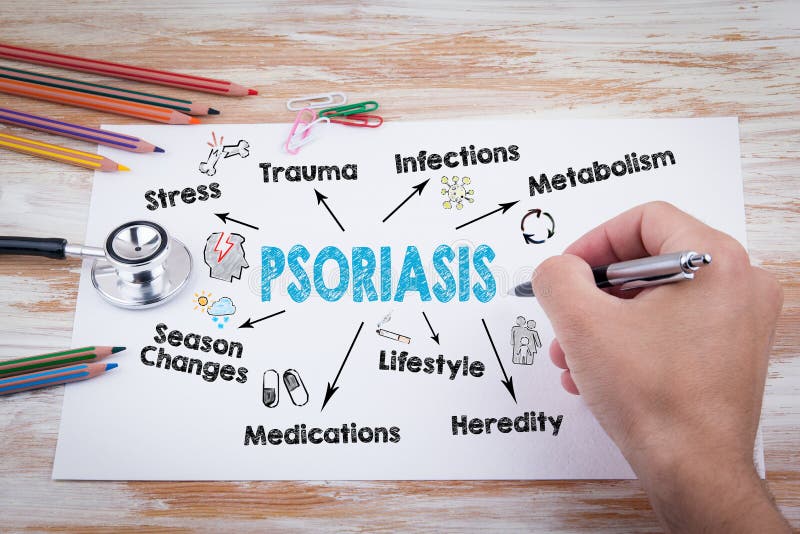 Psoriasis Concept. Chart with Keywords and Icons Stock Photo - Image of ... Psoriasis Concept. Chart with Keywords and Icons Stock Photo - Image of ...