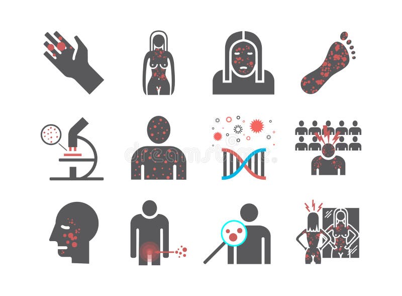 Psoriasis Icons Set. Symptoms, Treatment Stock Illustration ...