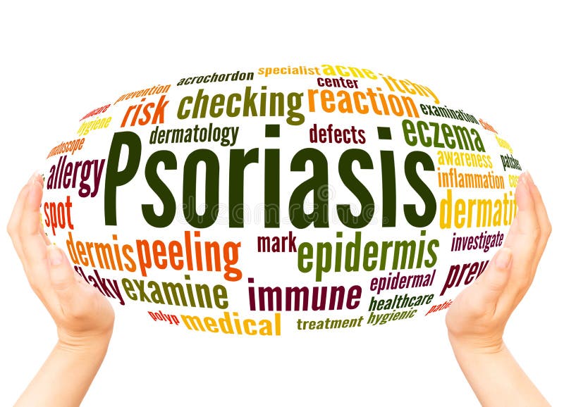 Psoriasis Concept. Chart with Keywords and Icons Stock Illustration ... Psoriasis Concept. Chart with Keywords and Icons Stock Illustration ...