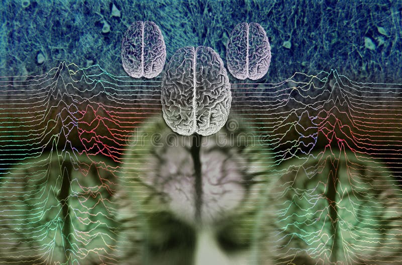 Psychiatry - Brain Imaging and Brain Mapping Stock Image - Image of ...
