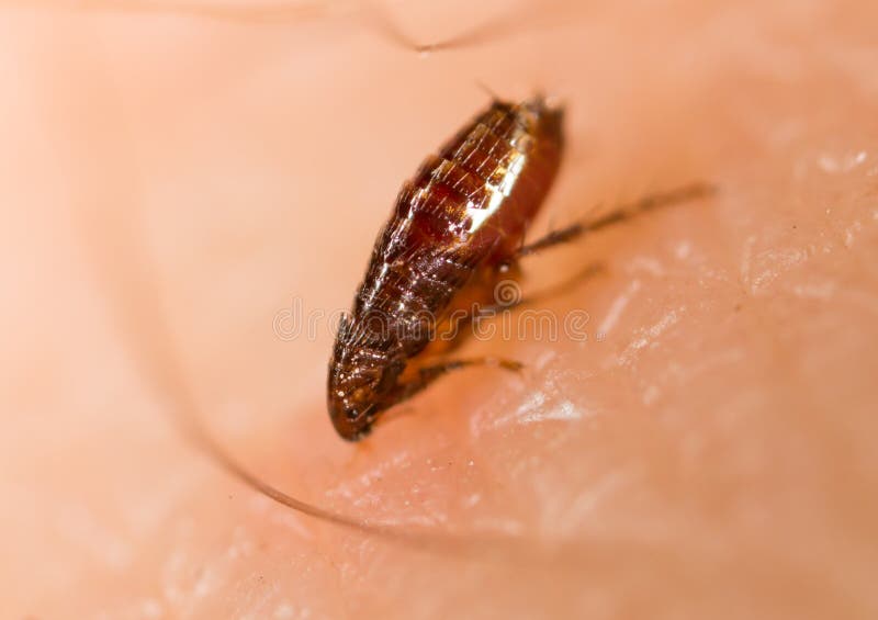 Pulga en piel humana foto de archivo. Imagen de fondo - 96103266