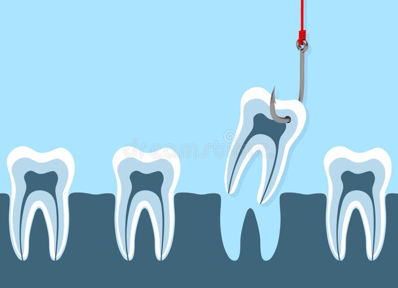 Pull a tooth stock illustration. Illustration of dental - 39354593