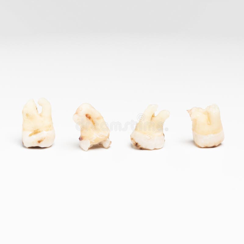 Pulled Out Bad Molars Human Teeth Close Up on White Background Stock ...