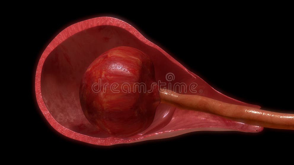2,028 Uterus Anatomy Stock Photos - Free & Royalty-Free Stock Photos ...