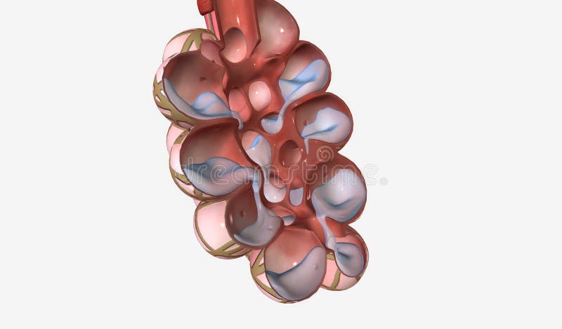 Pulmonary Edema is a Condition Caused by Too Much Fluid in the Lungs ...