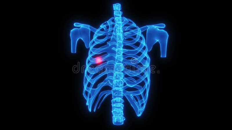 Pulsating Dull Pain in the Ribs Skeletal Rotate Endless Stock Video ...