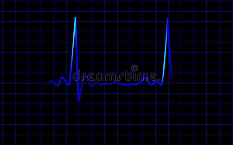 Pulse beat stock illustration. Illustration of colour - 4408268