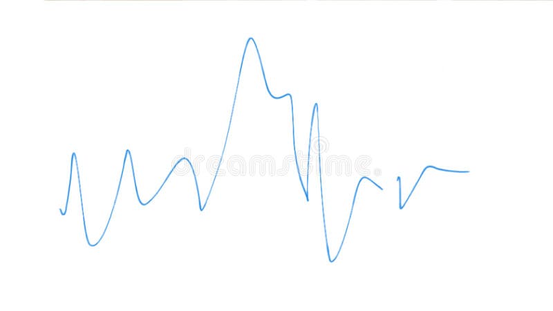 Pulse or Cardiogram Pattern. Blue Waves on White Background Stock Image ...