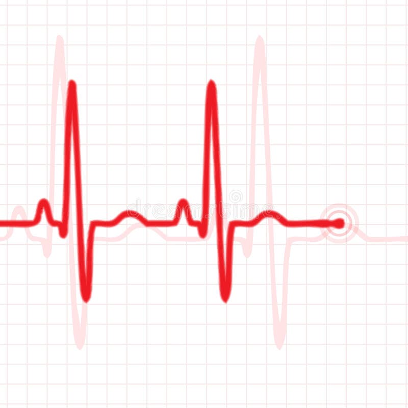Heart Normal Sinus Rhythm on Electrocardiogram Stock Vector ...