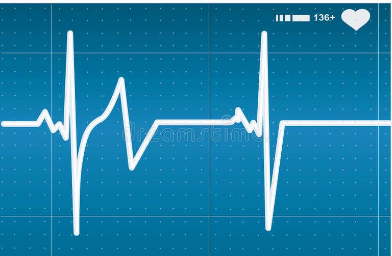 Monitor Pulse Trace Stock Illustrations – 1,658 Monitor Pulse Trace ...