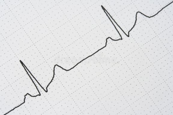 Pulse trace stock image. Image of electrocardiogram, electrical - 4298641