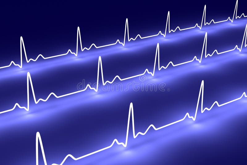 Fast Normal Slow Heartbeat Ecg Stock Illustration - Illustration of ...