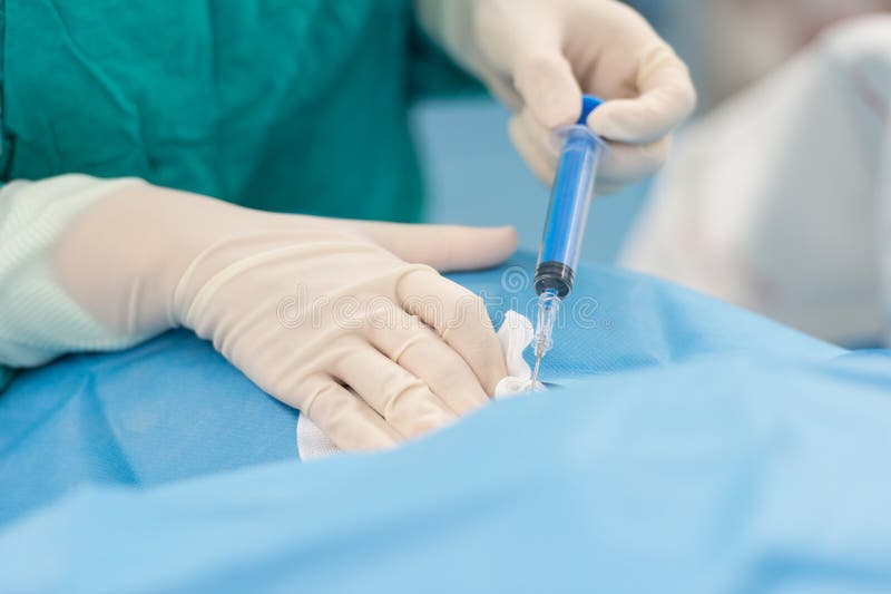 Punctuur Interne Ader Van De Halsslagader Stock Afbeelding - Image of ...