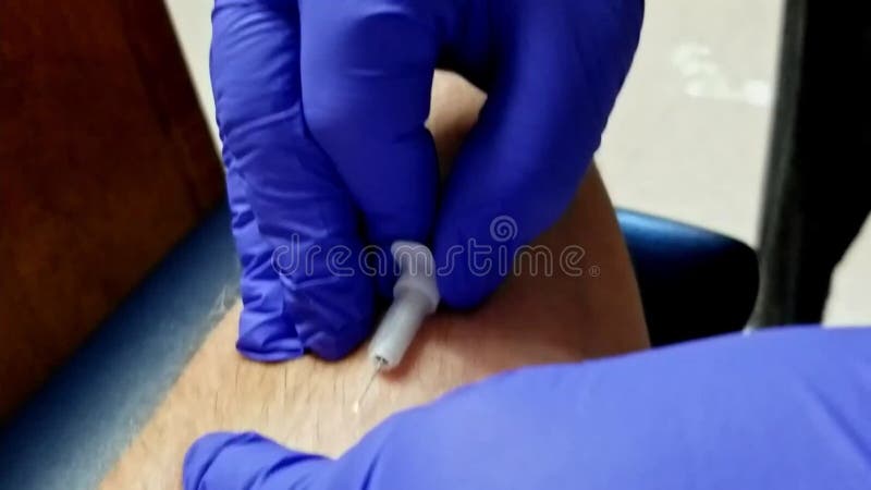 Purified Protein Derivative -PPD- Subcutaneous Injection Stock Footage ...