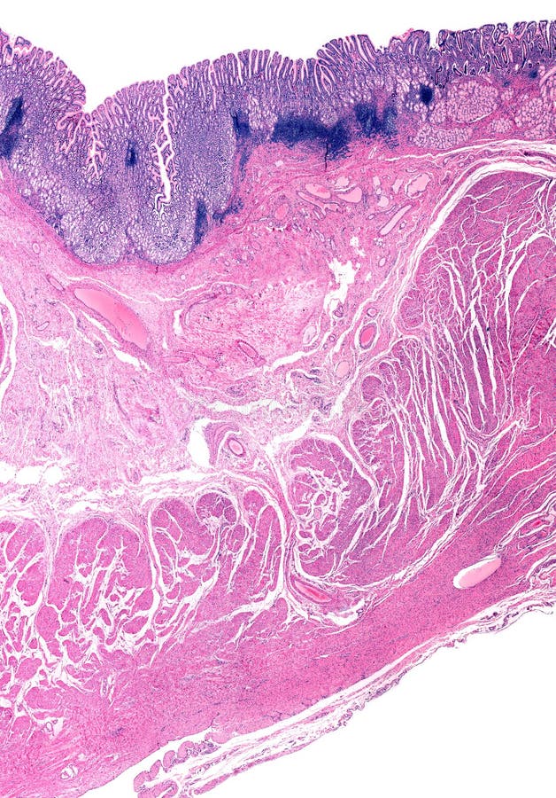 Pylore image stock. Image du musculaire, micrographe - 117240669