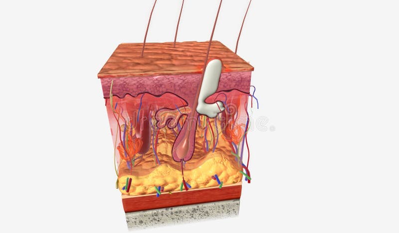 Gangrenosum Stage Stock Illustrations – 12 Gangrenosum Stage Stock ...