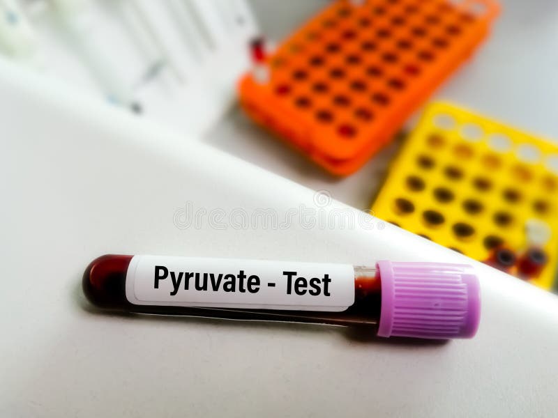 Pyruvate test stock photo. Image of closeup, test, hospital - 278142922