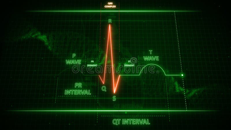 QRS Complex from Electrocardiogram Wave or ECG or EKG Stock ...
