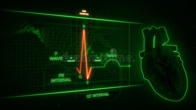 QRS Complex from Electrocardiogram Wave or ECG or EKG Stock ...