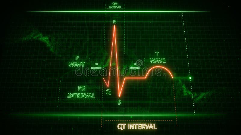 QT Interval of Electrocardiogram Wave or ECG or EKG Stock Illustration ...