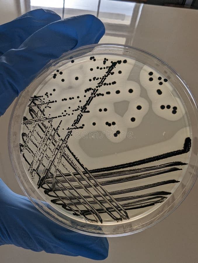 Quadrant Streak of Staphylococcus Aureus on Baird Parker Agar Plate ... Quadrant Streak of Staphylococcus Aureus on Baird Parker Agar Plate ...