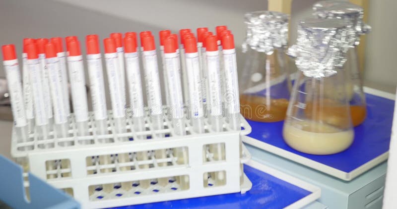 Quality Check of Food and Beverages in a Laboratory, the Samples are ...