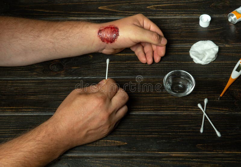 For Quick Healing, the Wound Must Be Treated with a Special Solution ...