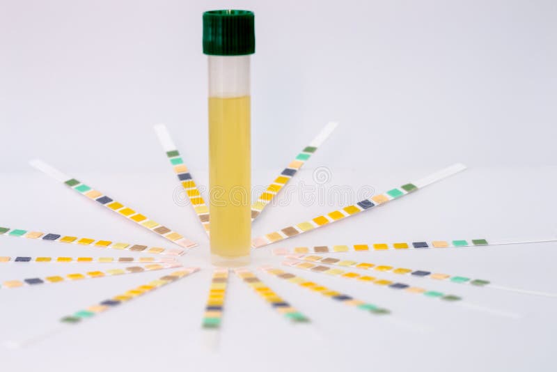 Urine Sample and Urine Strips Stock Photo - Image of bottle, infection ...