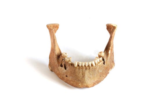 Quijada humana imagen de archivo. Imagen de faltante, médico - 5468051