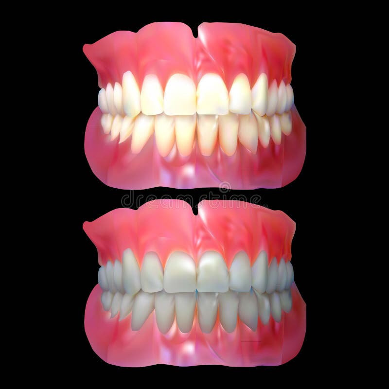 Quijada Ilustraciones Stock, Vectores, Y Clipart – (17,001 ...