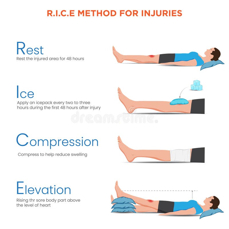 R.I.C.E Method for Injuries Rest, Ice, Compression, and Elevation for ...