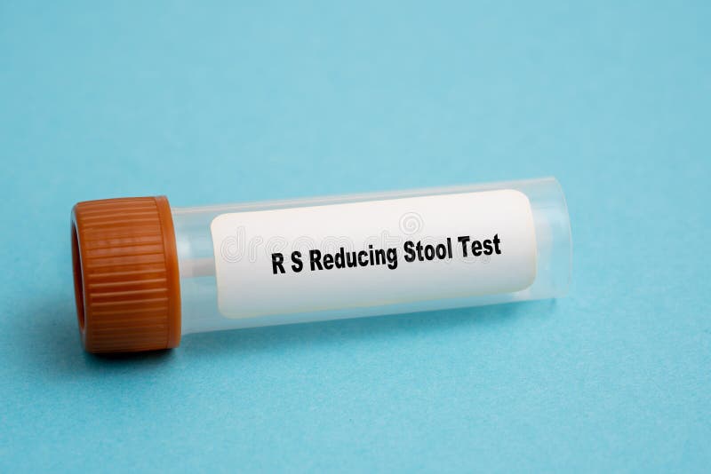 R S Reducing Stool Test stock image. Image of checkup - 270236979