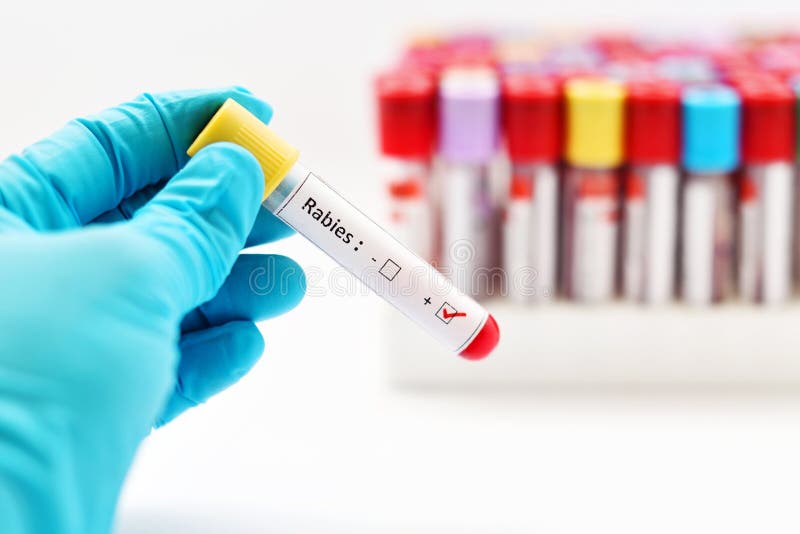 Blood for Rabies Virus Test Stock Image - Image of mammalia, disease ...