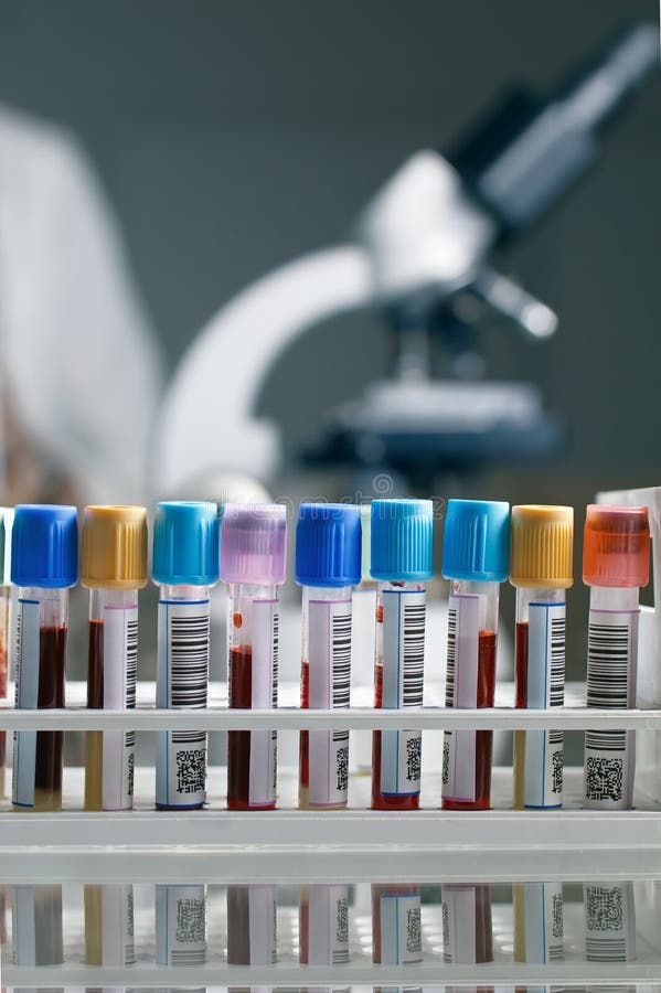 Rack with blood samples stock photo. Image of blue, chemical - 22919890