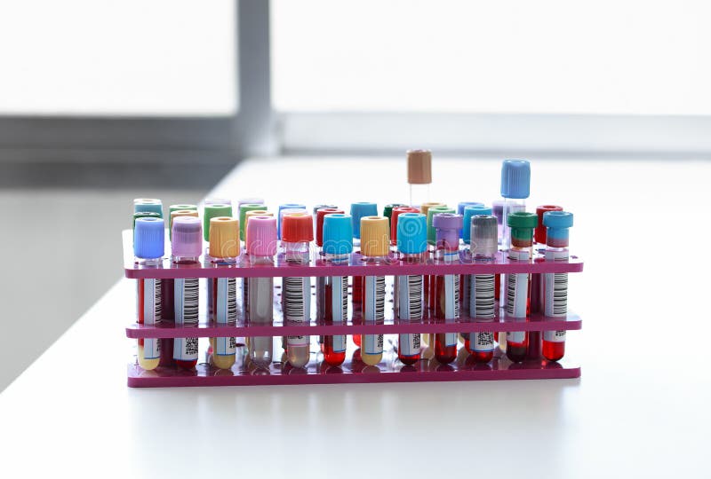 Rack with Blood Samples in Tubes in the Lab Stock Photo - Image of ...