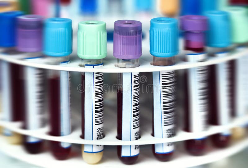 Blood tubes stock photo. Image of genetic, professional - 36857712