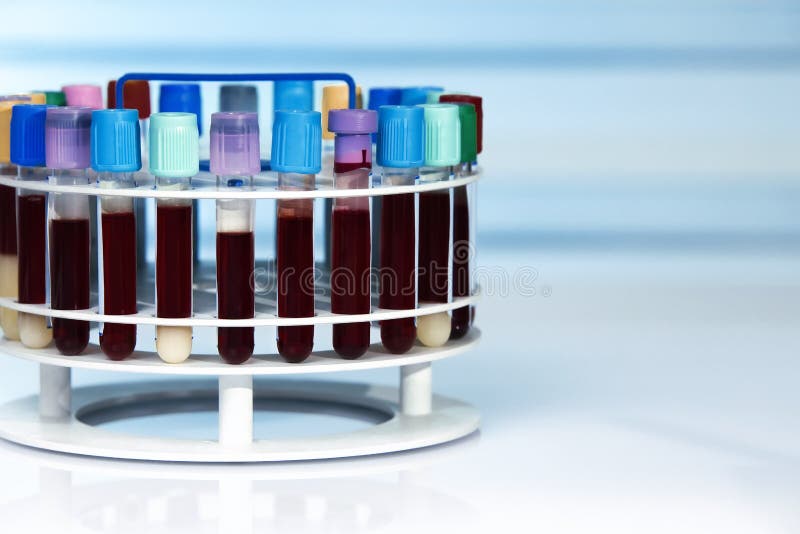 Rack of Blood Tubes with Samples in the Laboratory Stock Image - Image ...