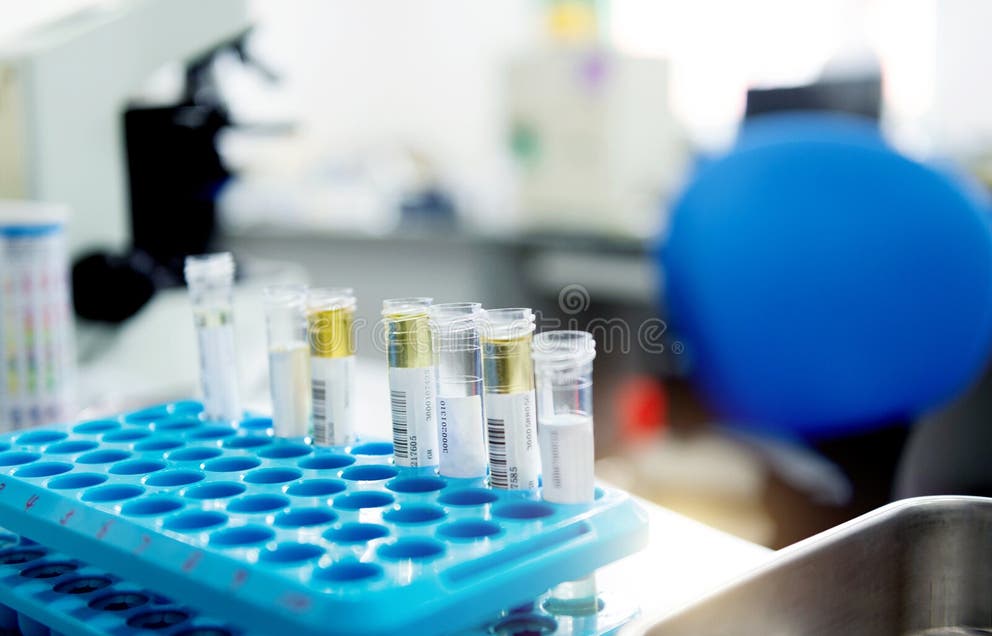 Rack with Group of Tubes and Microscope Stock Image - Image of plastic ...