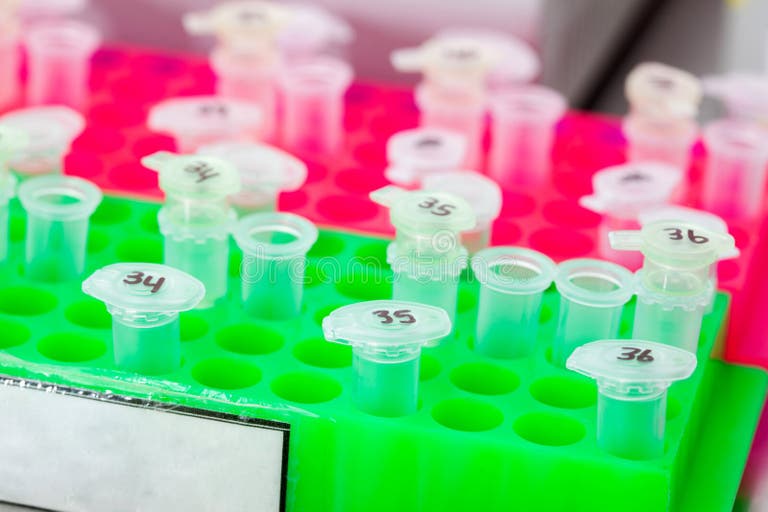 Rack of Test Tubes Being Used for DNA Extraction Using the Spin Column ...