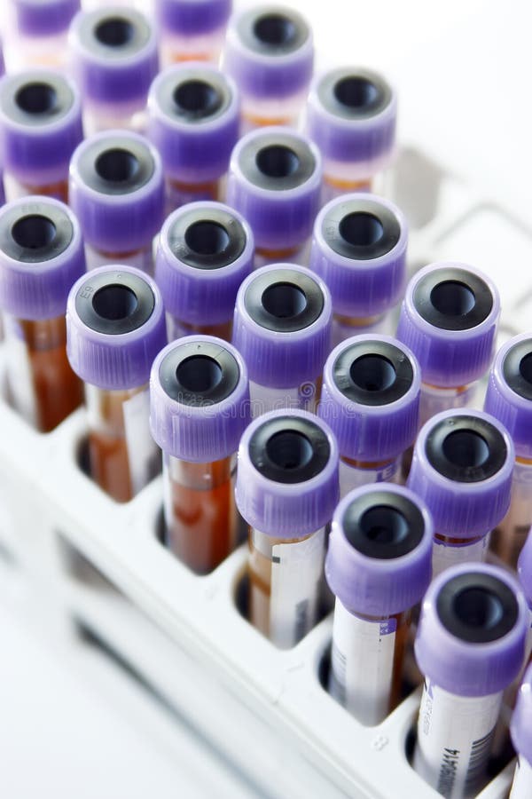 Rack With Test Tubes And Microscope On Table In Laboratory, Space For ...