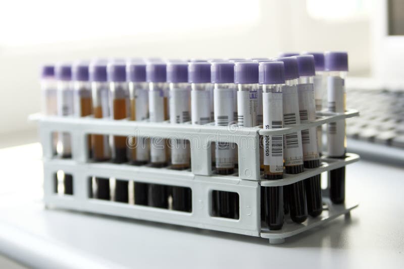 Rack Of Blood Tubes With Name For Proper Identification In Nurse At ...
