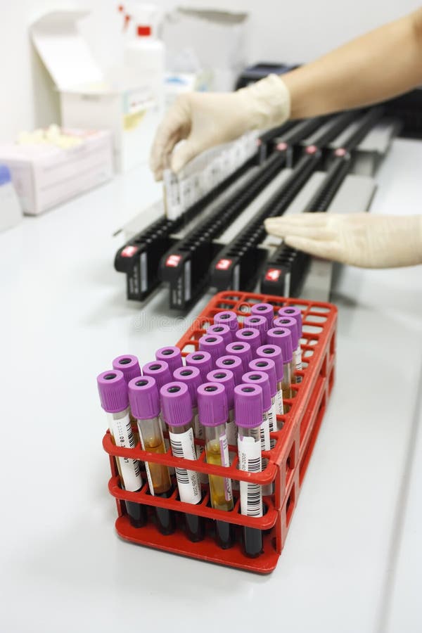 Rack with Test Tubes of Blood Editorial Image - Image of label, examine ...