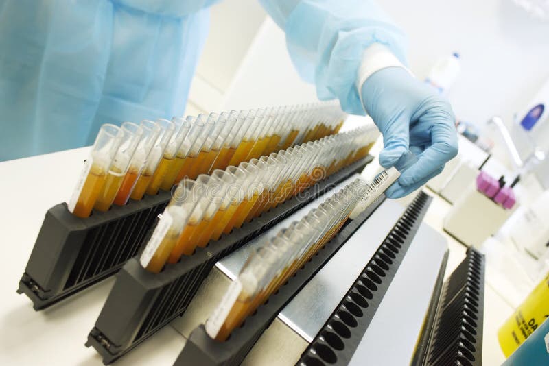Rack with Test Tubes of Blood Editorial Photo - Image of analysis ...