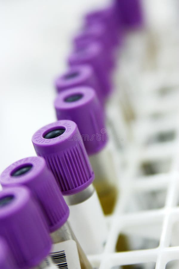 Rack with Test Tubes of Blood for Laboratory Analysis Editorial Image ...