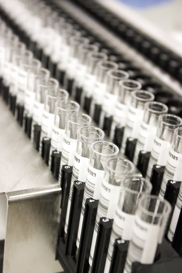 Rack with Test Tubes of Blood for Laboratory Analysis Editorial Image ...