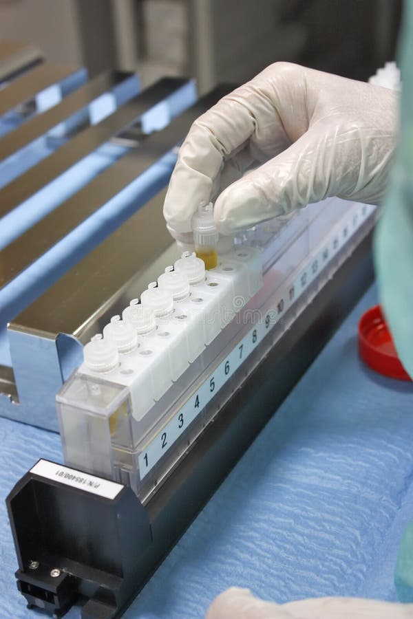 Rack with Test Tubes of Blood for Laboratory Analysis Editorial Image ...