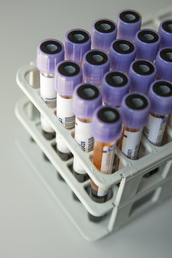 Rack with Test Tubes of Blood Editorial Stock Photo - Image of hospital ...